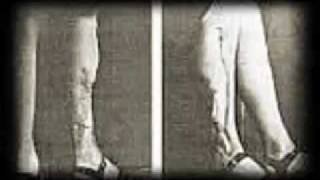 All comments on JOSEF MENGELE EXPERIMENTS-- ANNIE GROSSENBACHER ...