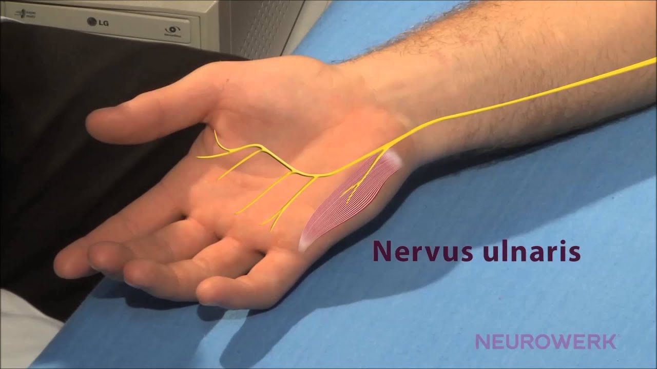 Motorische Neurographie - Ulnaris - YouTube