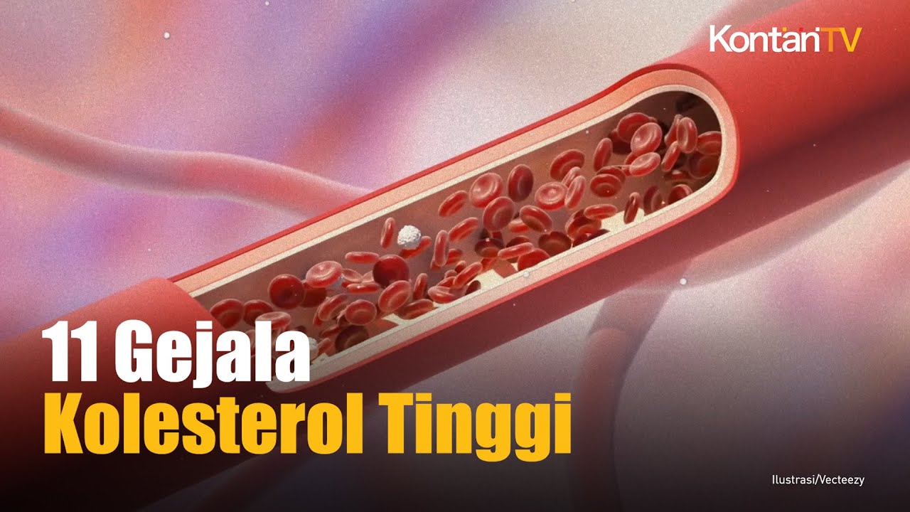 11 Gejala Kolesterol Tinggi yang Wajib Diwaspadai