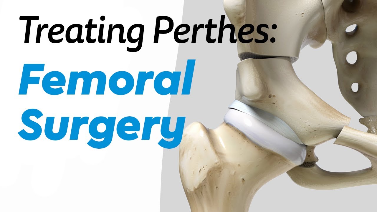 Legg Calv Perthes Disease Children s Hospital Colorado