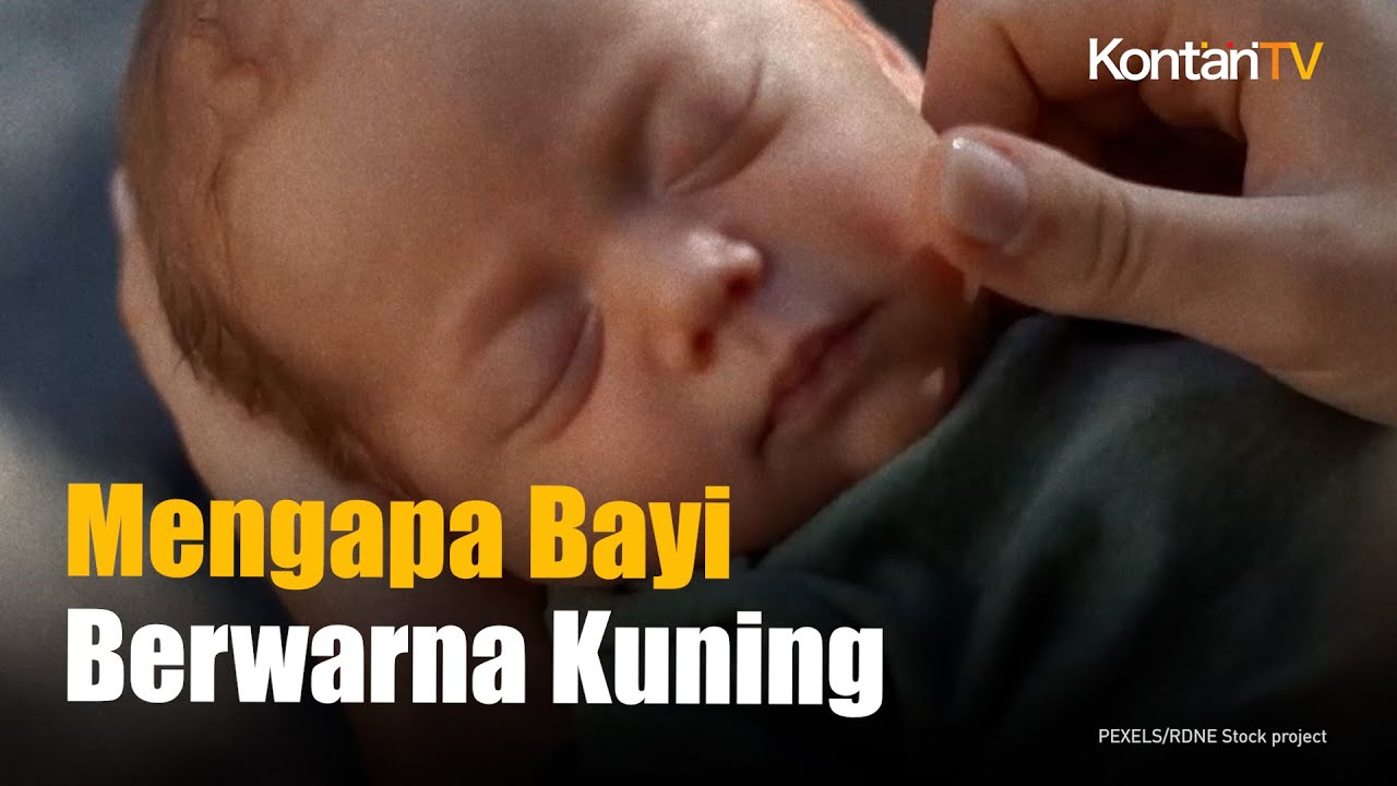 Mengapa Bayi Bisa Kuning? Ini Penyebab, Ciri-Ciri, dan Langkah Awal ...