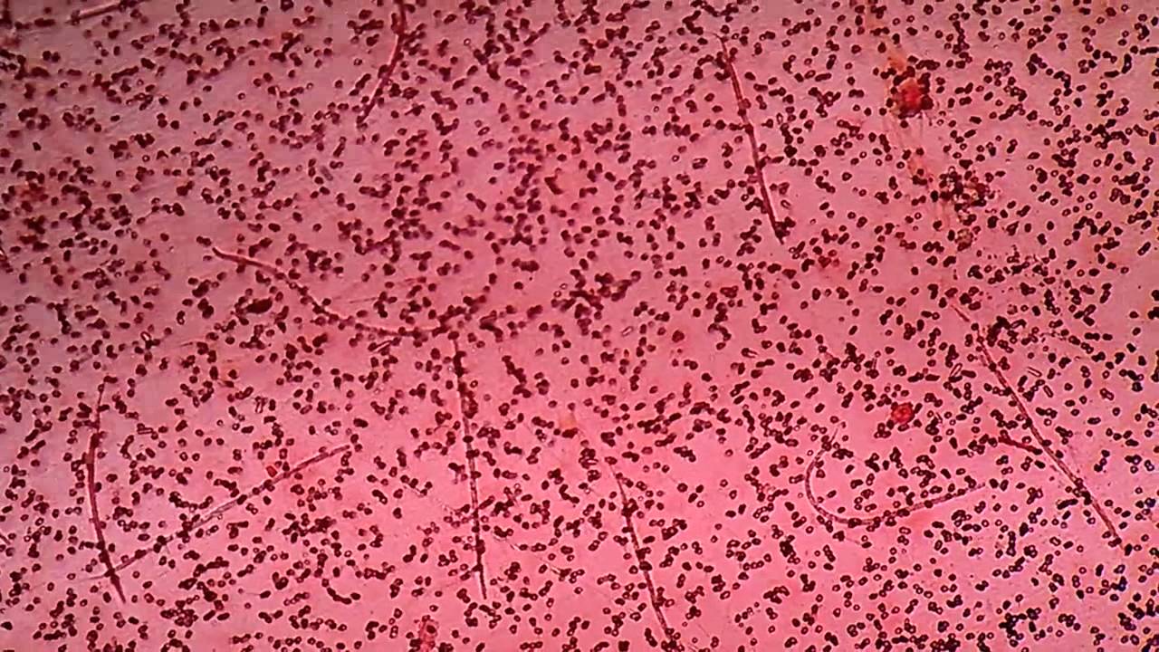 Heartworm microfilaria in a blood smear-Perimeter Veterinary Center ...