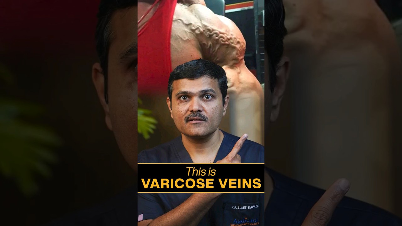 vascular-endovascular-video-gallery-dr-sumit-kapadia