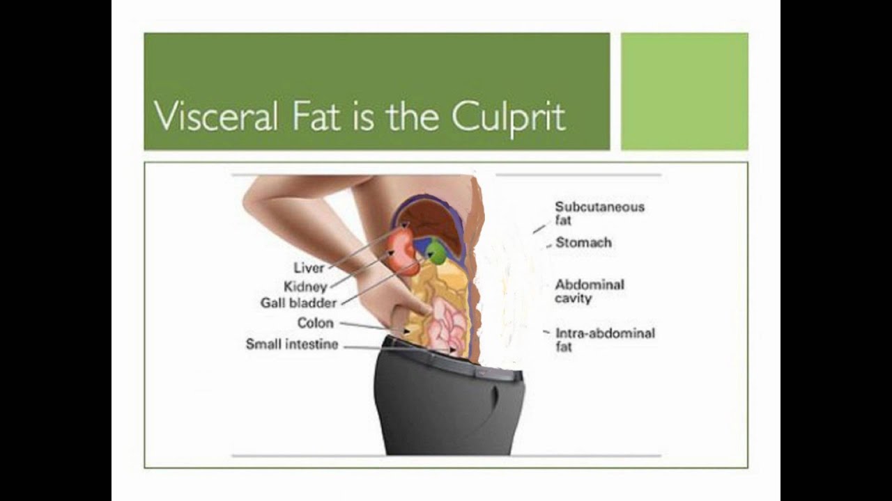 Does Salt Intake Cause Diabetes What Is Visceral Fat And How To Get 
