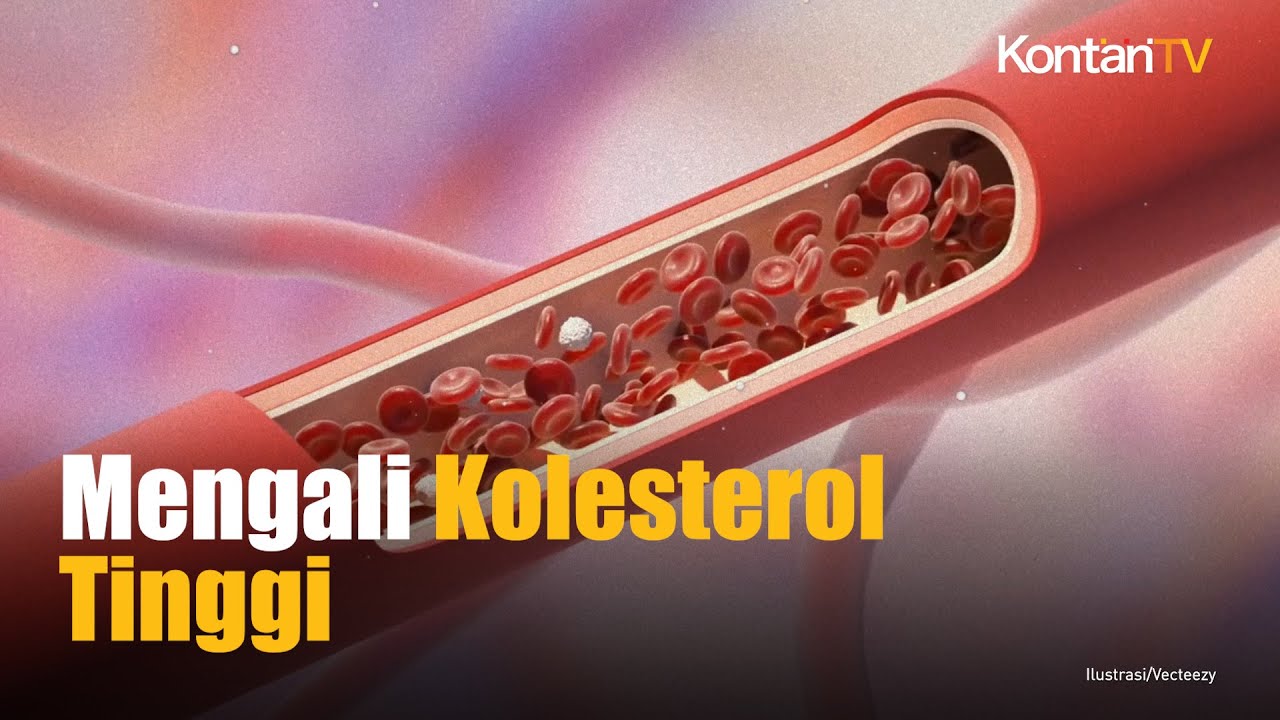 Kenali 5 Gejala Kolesterol Tinggi yang Sering Dialami | Info Sehat