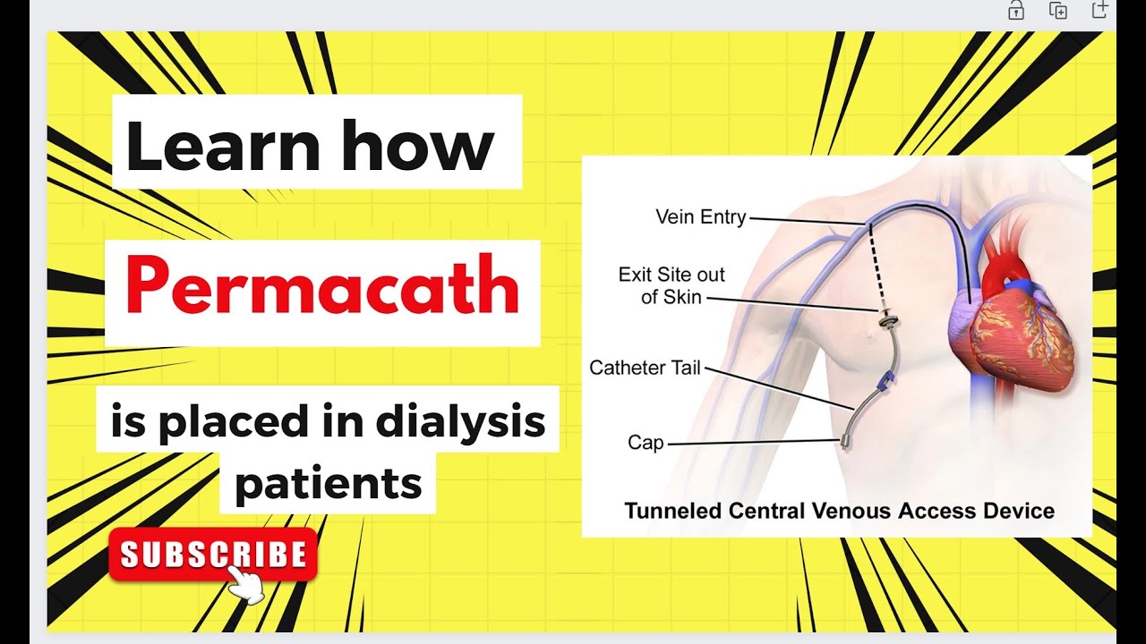 Top 5 Key Signs and Symptoms of Deep Vein Thrombosis (DVT)